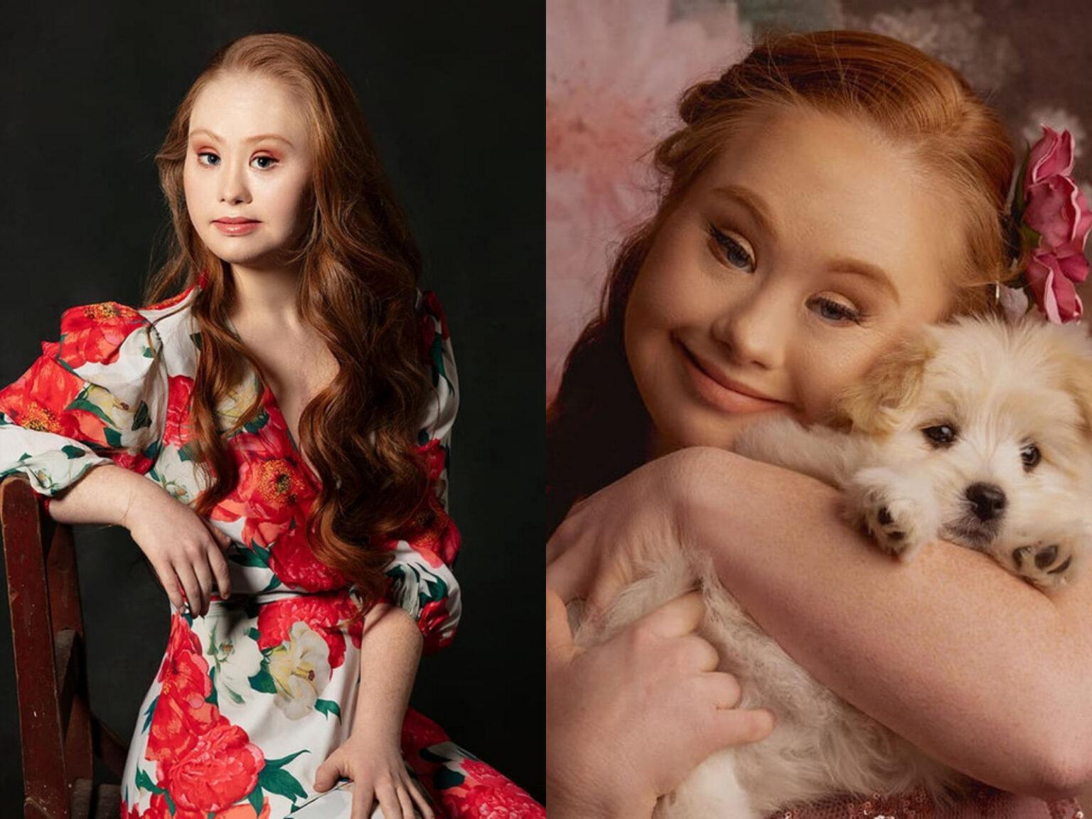 Η ιστορία της Madeline Stuart: Το μοντέλο με σύνδρομο Down και αυτισμό ...