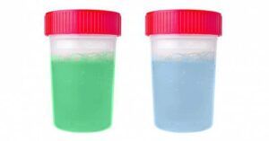 Πρόβλημα με το συκώτι όγκοι ή ουρολοίμωξη: 7 πράγματα που λένε τα ούρα ...