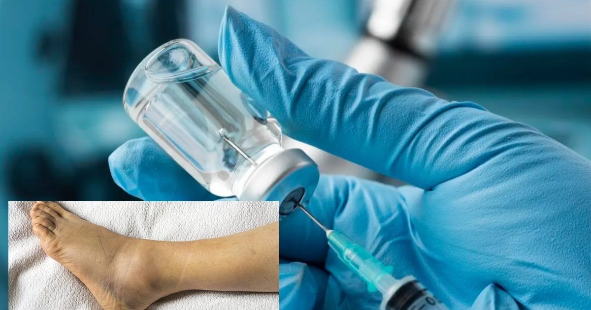 Κορτιζόνη : Οι παρενέργειες του φαρμάκου και σε ποιες περιπτώσεις ...