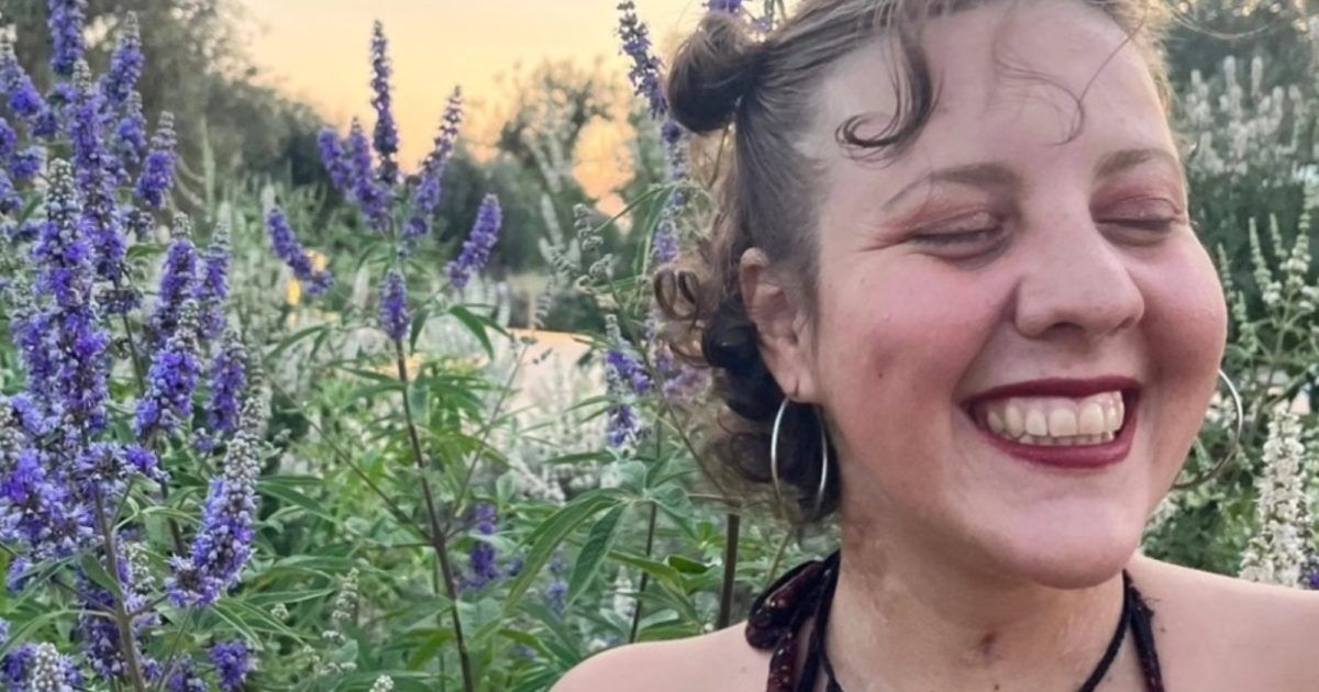 Πέθανε η Αναστασία Τασούλα: Η πρώτη ασθενής με κυστική ίνωση